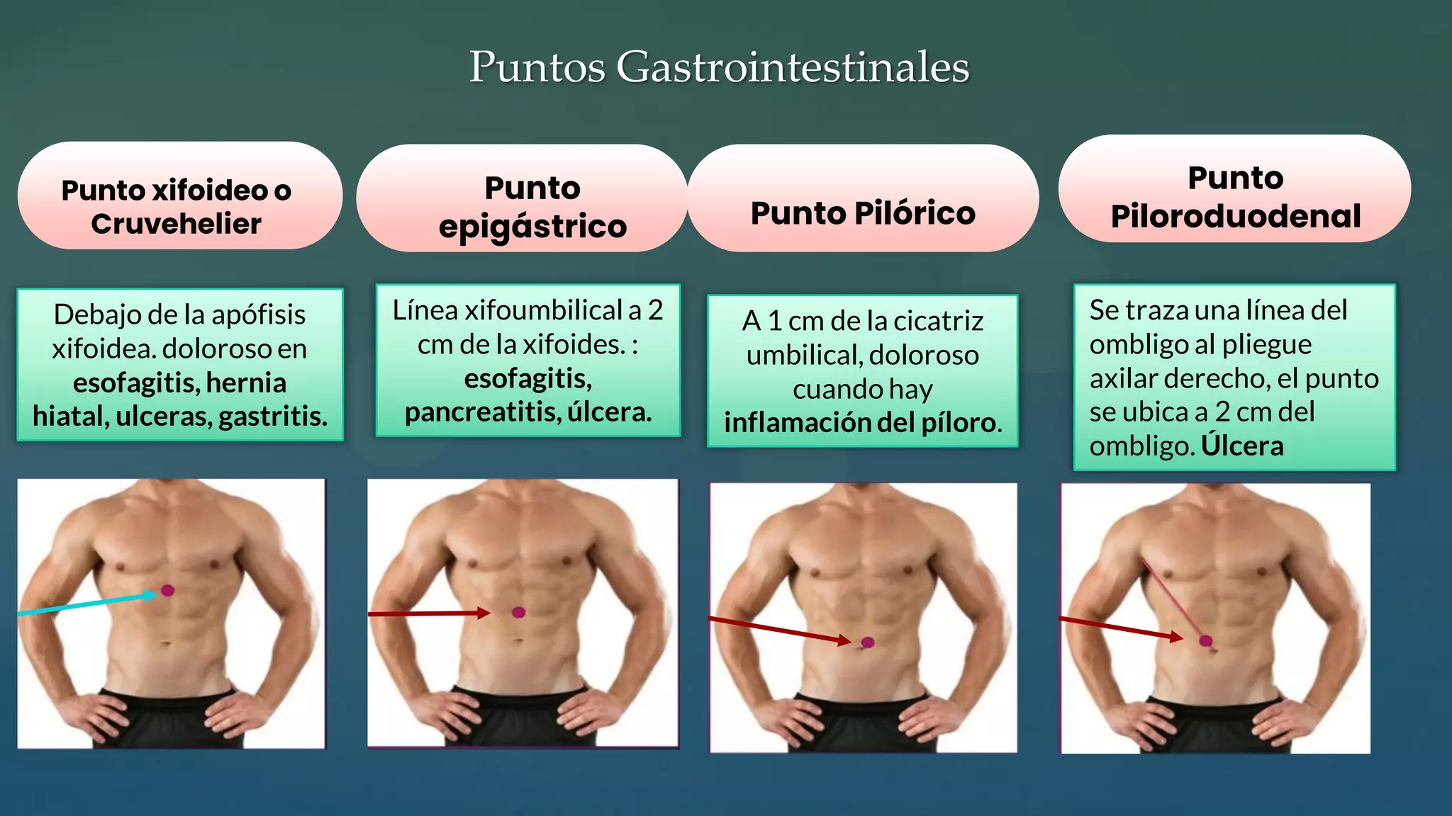 Puntos dolorosos.pdf