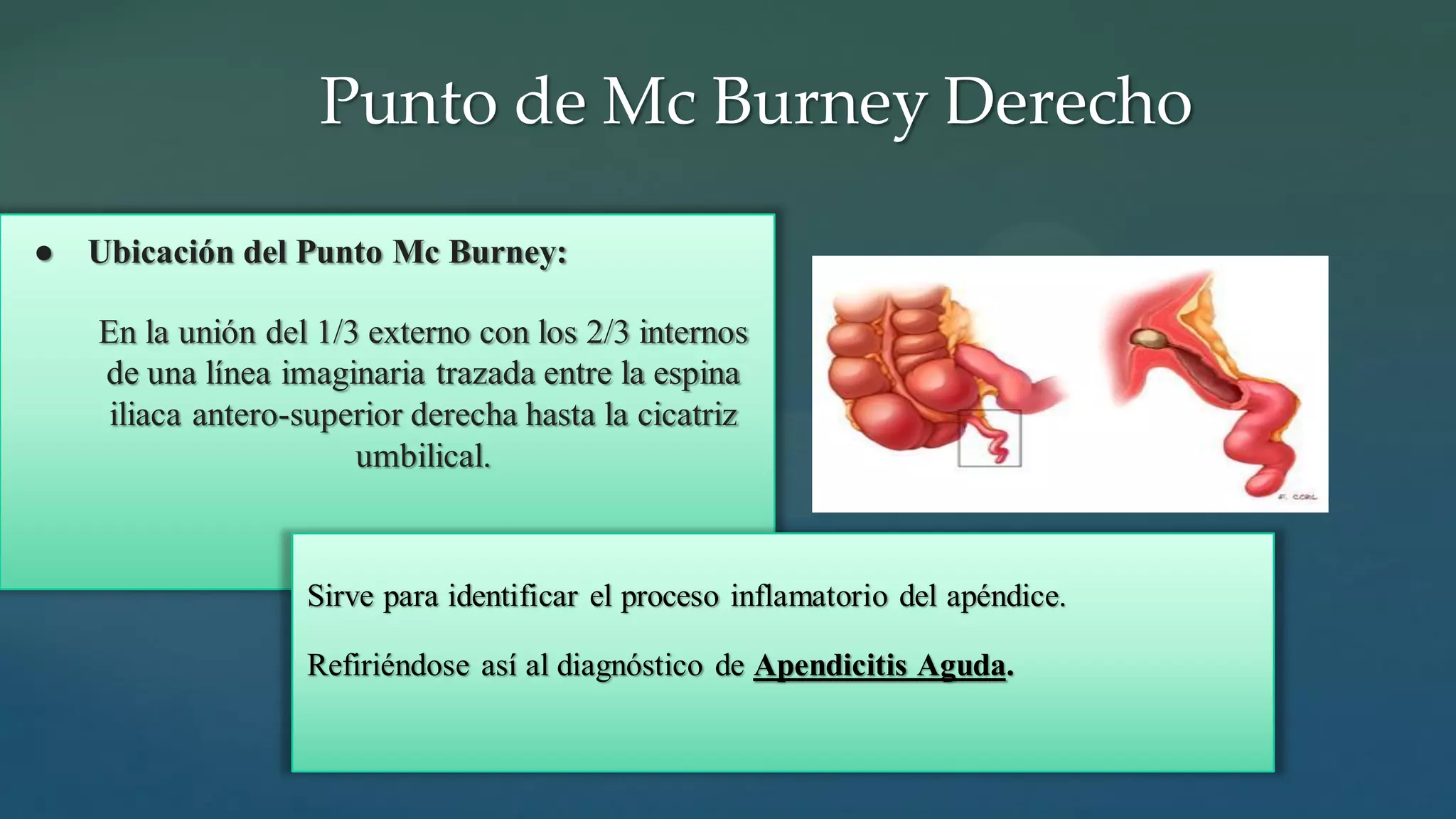 Puntos dolorosos.pdf