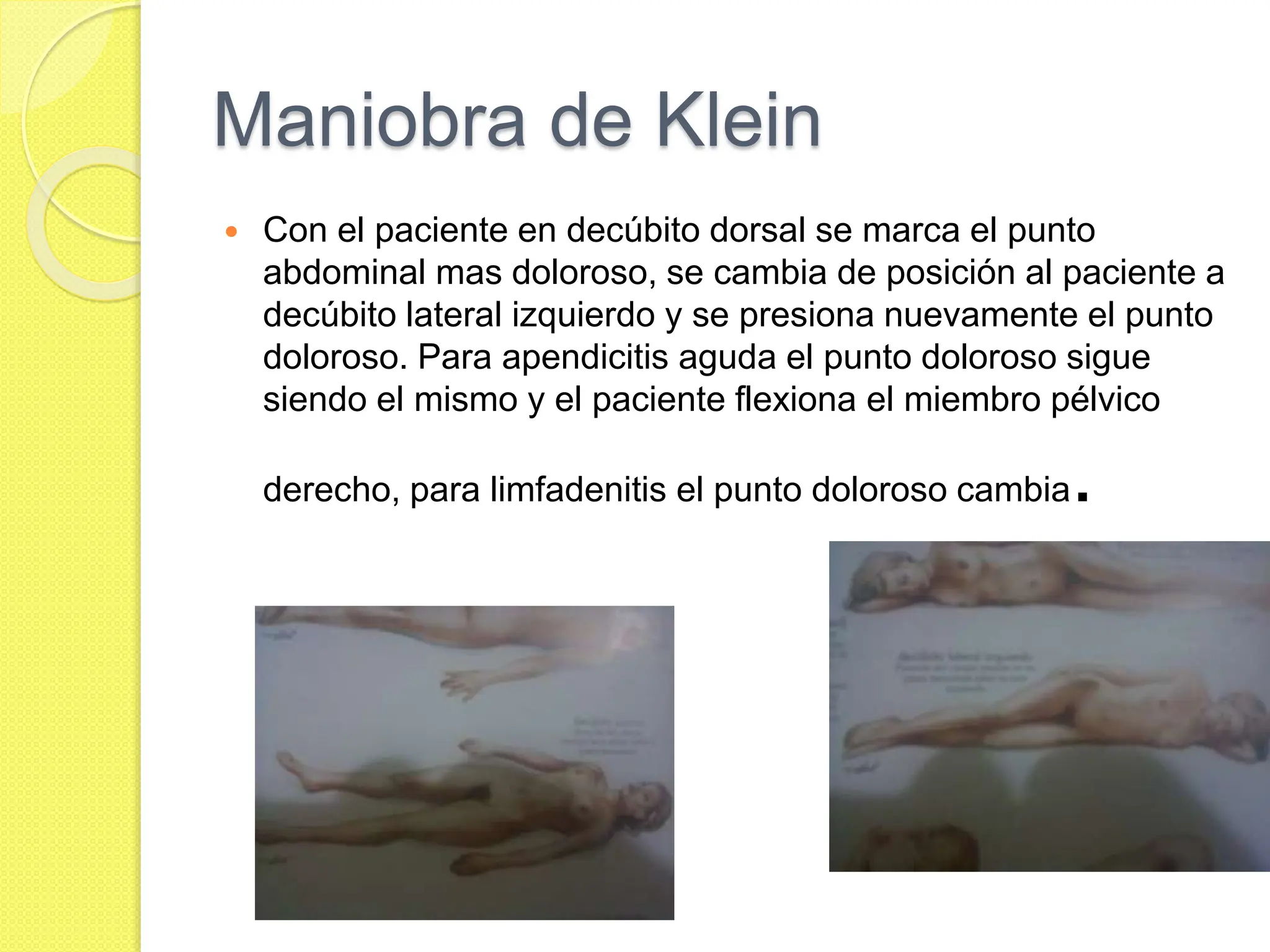 Signos apendiculares para diagnosticar apendicitis | PPT