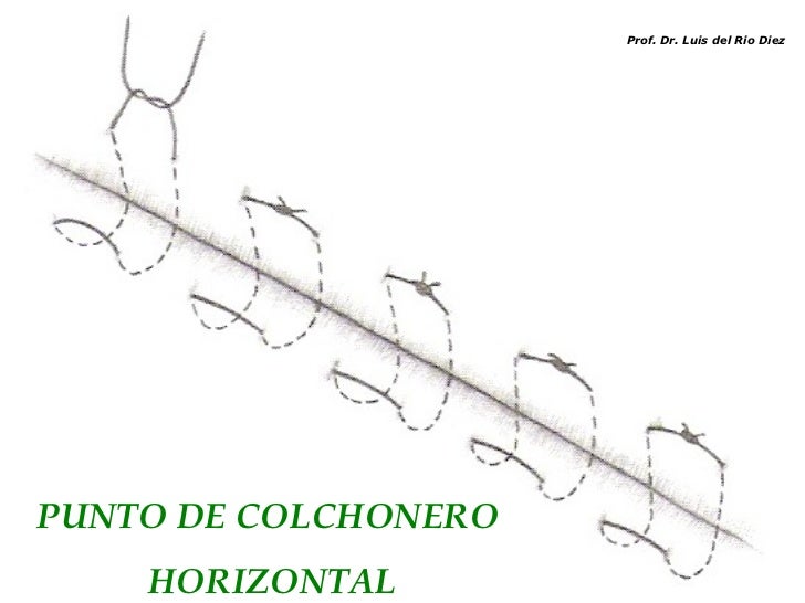 PUNTOS QUIRURGICOS . Prof. Dr. Luis del Rio Diez