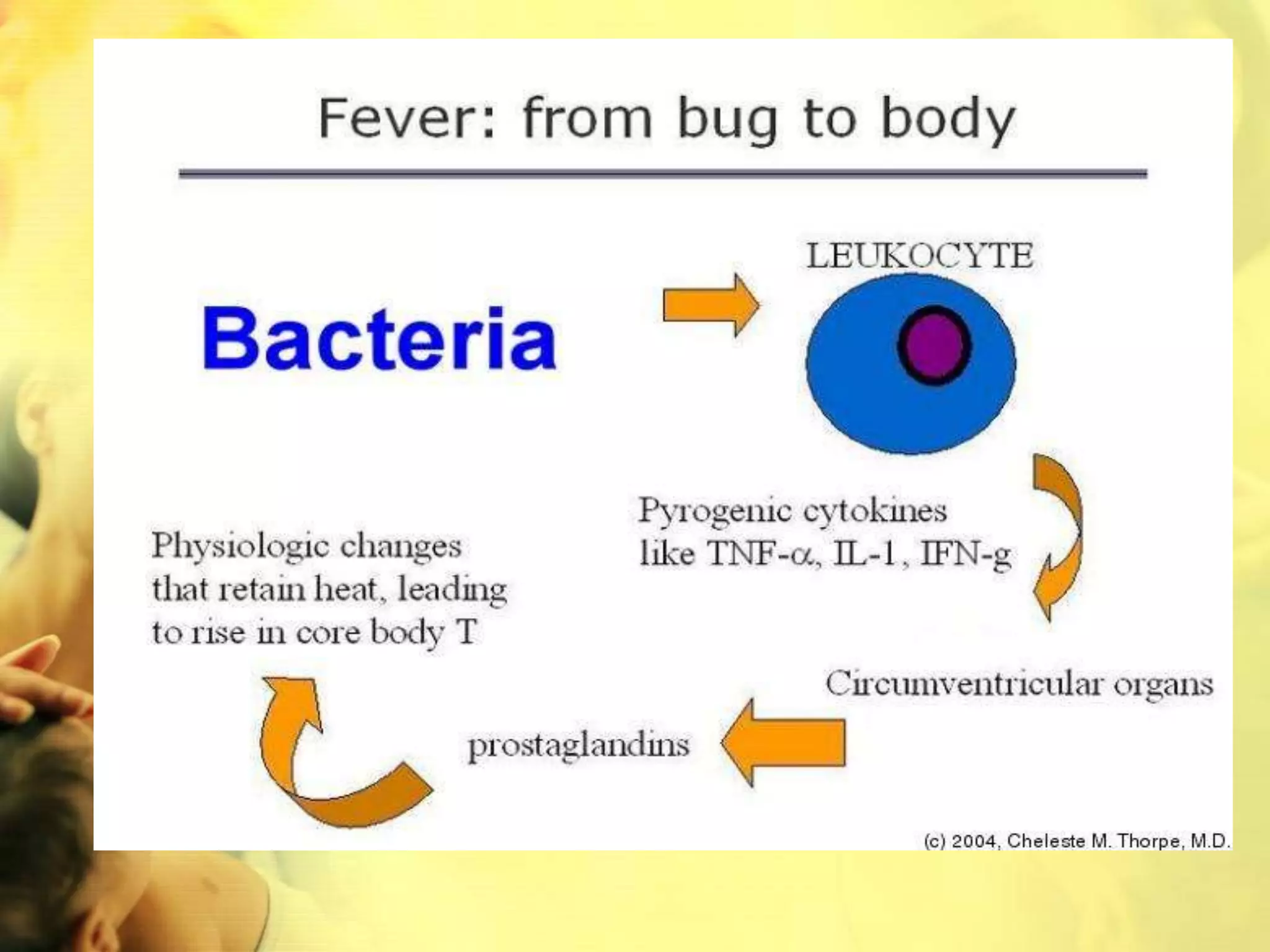 PYREXIA OF UNKNOWN ORIGIN(PUO) | PPTX