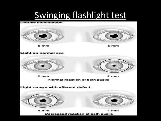 Pupil - SSJ,CALICUT MEDICAL COLLEGE