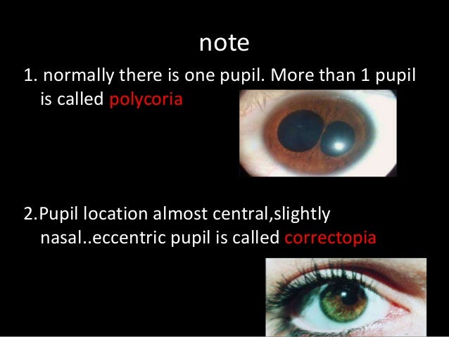 Pupil - SSJ,CALICUT MEDICAL COLLEGE