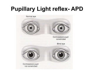 Pupil | PPT