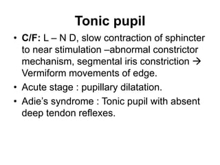 Pupil | PPT