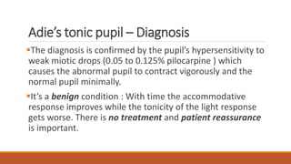 Pupil | PPTX