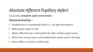 Pupil | PPT