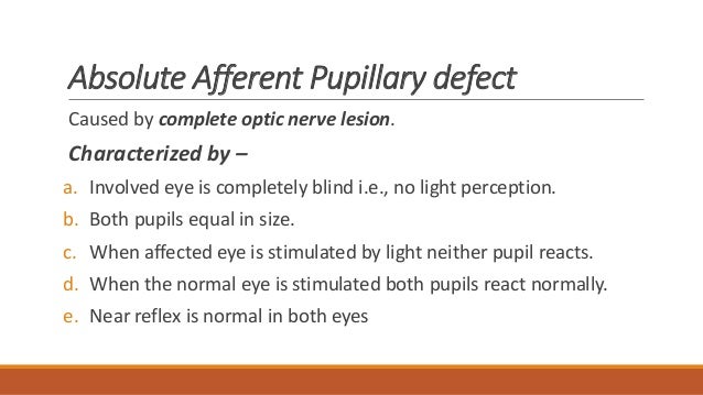 Afferent Pupillary Defect