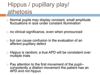 Hippus Pupil Reaction