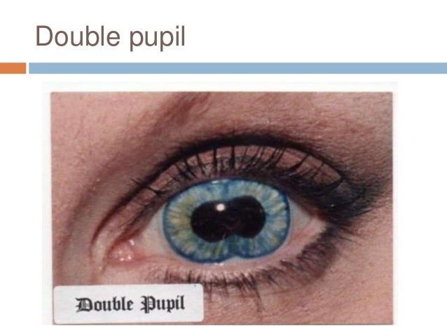 Pupil