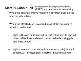 Pupil.ppt | Death, Injury, or Military Conflict | Sensitive Topics