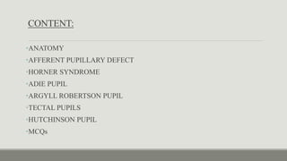 Pupil abnormalities | PPTX