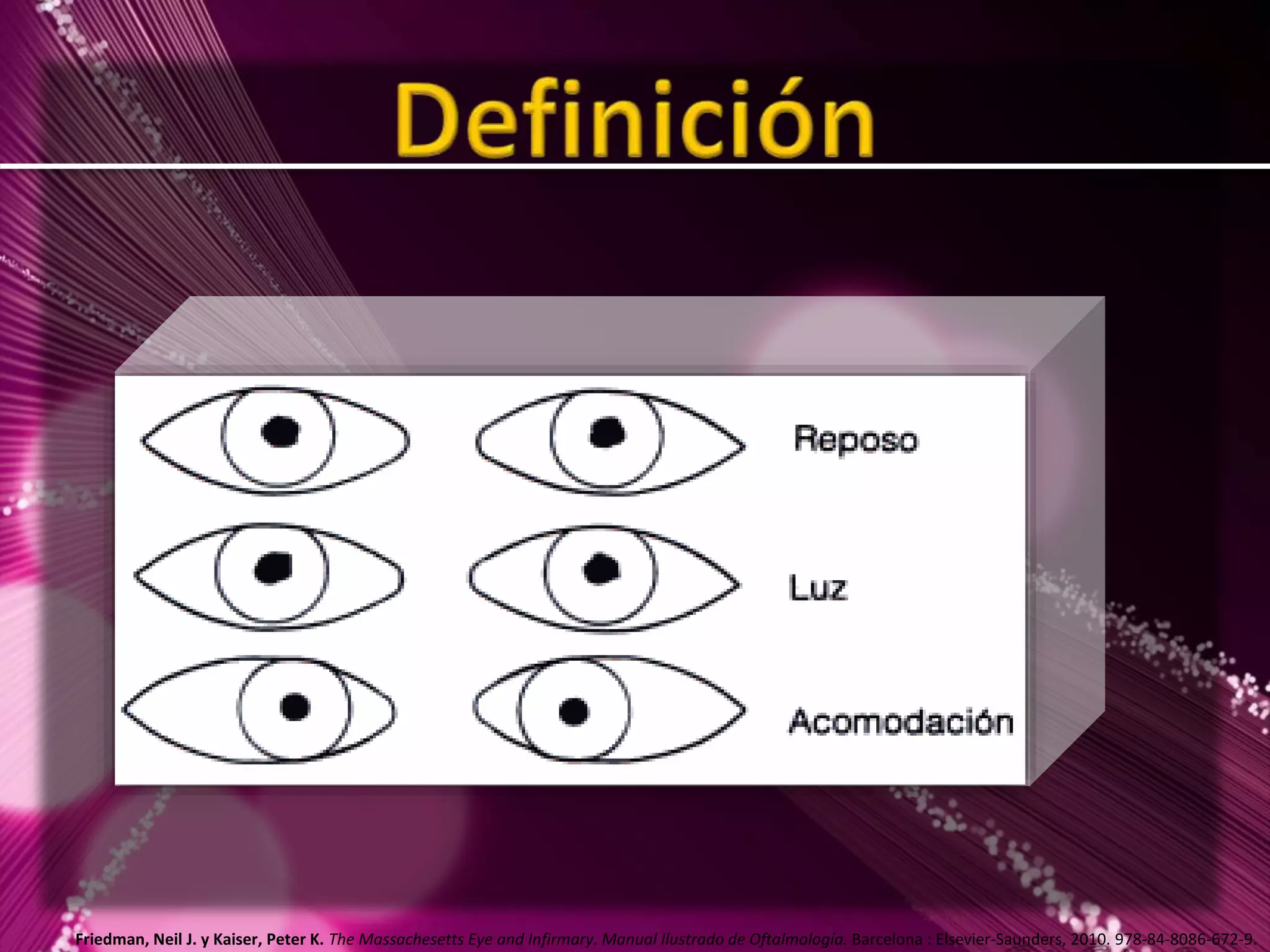 Pupila de Argyll Robertson | PPT