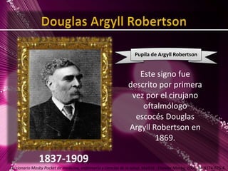 Pupila de Argyll Robertson | PPSX