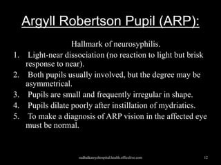 Pupil and its abnormalities sept 4 9-2010 | PPTX