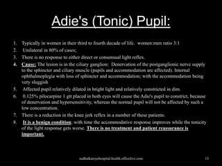 Pupil and its abnormalities sept 4 9-2010 | PPTX