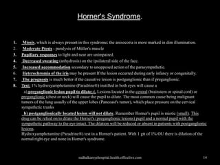 Pupil and its abnormalities sept 4 9-2010 | PPT
