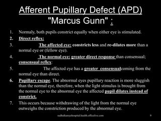 Pupil and its abnormalities sept 4 9-2010 | PPT