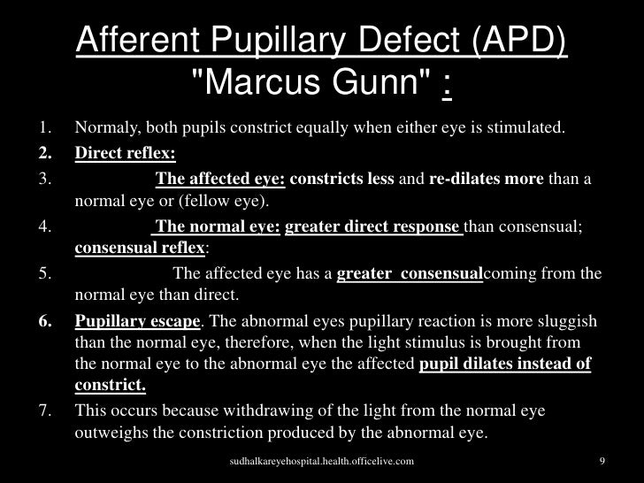 Pupil and its abnormalities sept 4 9-2010