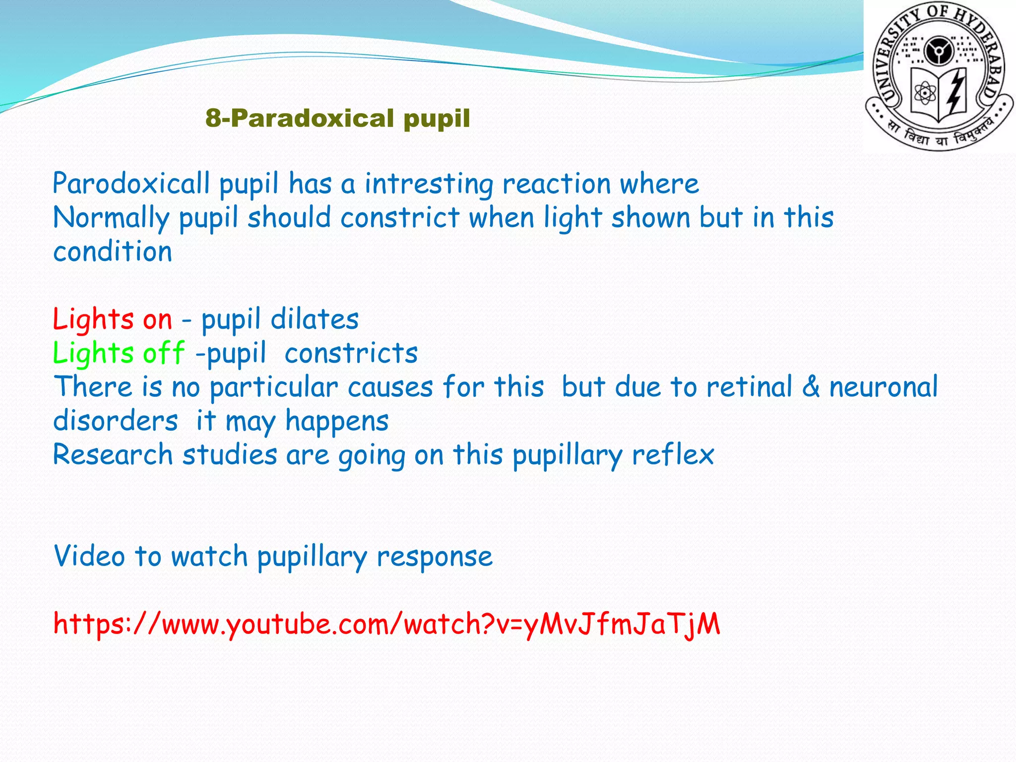 Pupil anomalies and disorders shiva ppt | PPTX | Eye and Vision ...