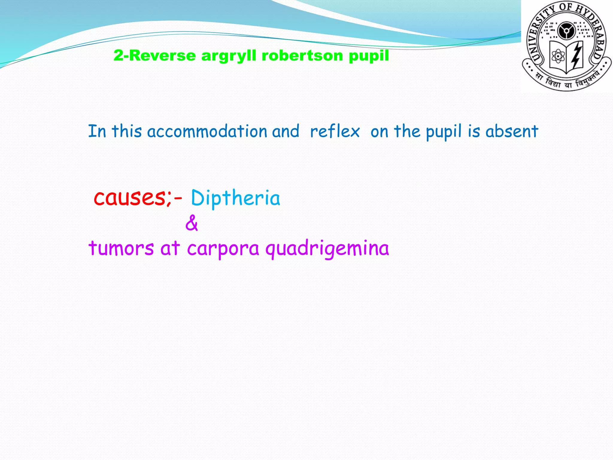 Pupil anomalies and disorders shiva ppt | PPTX | Eye and Vision ...