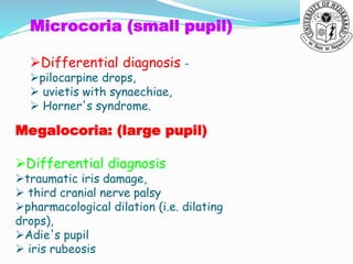 Pupil anomalies and disorders shiva ppt | PPTX | Eye and Vision ...