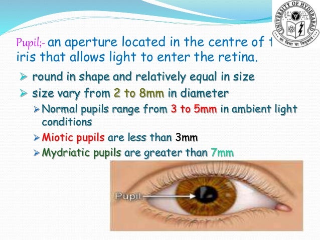 Pupil anomalies and disorders shiva ppt