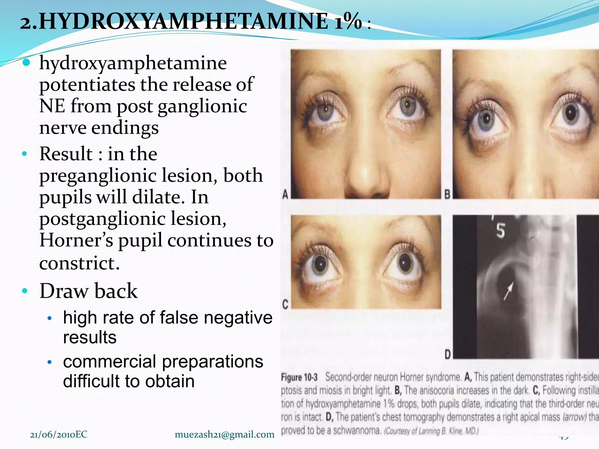 PUPILARY ABNORMALITY AND PHARMACOLOGIC TESTS.pptx
