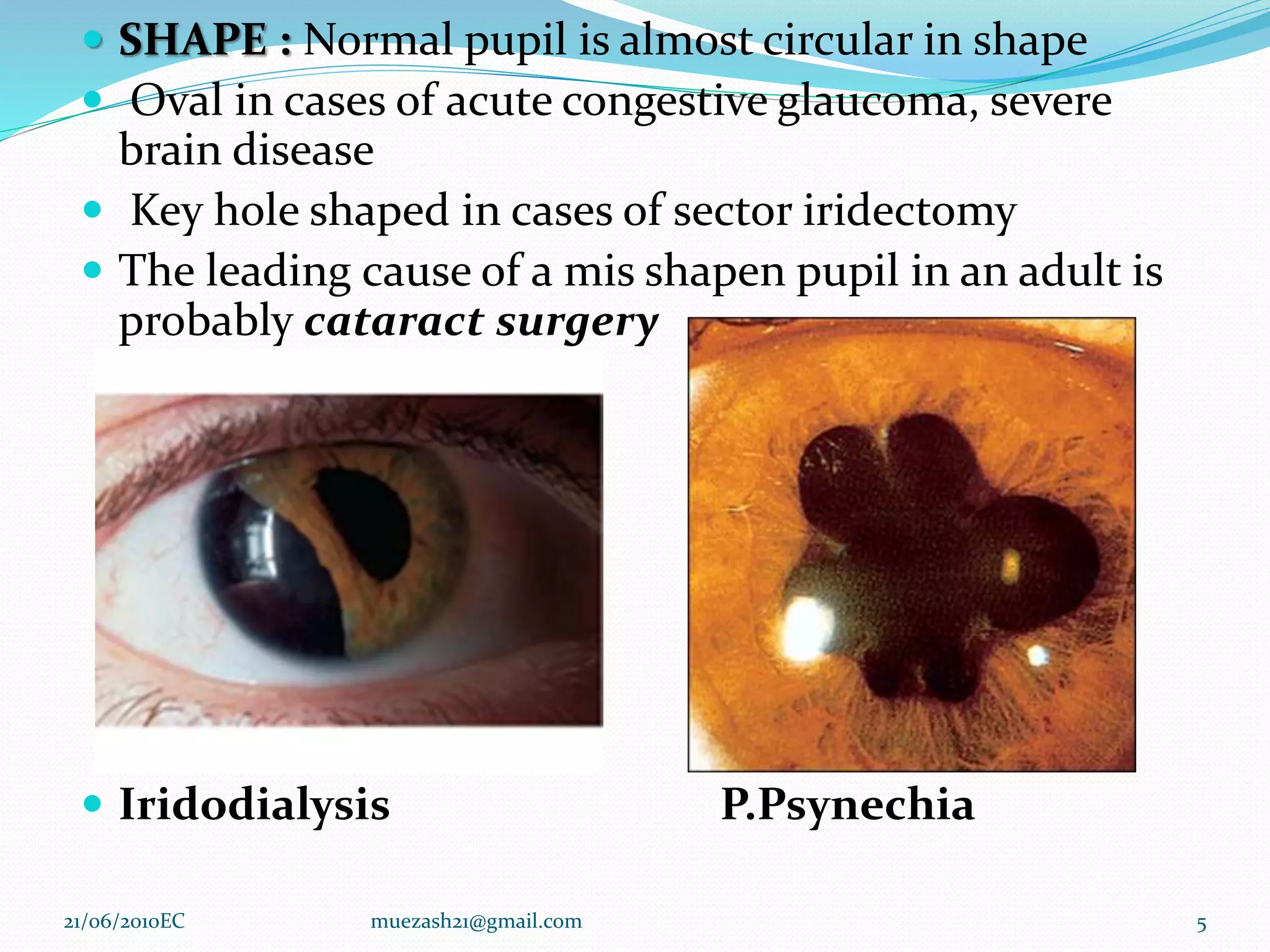 PUPILARY ABNORMALITY AND PHARMACOLOGIC TESTS.pptx