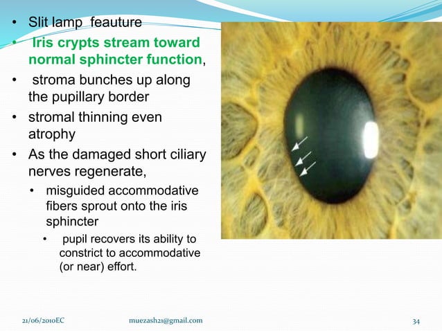 PUPILARY ABNORMALITY AND PHARMACOLOGIC TESTS.pptx