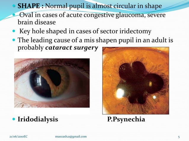 PUPILARY ABNORMALITY AND PHARMACOLOGIC TESTS.pptx