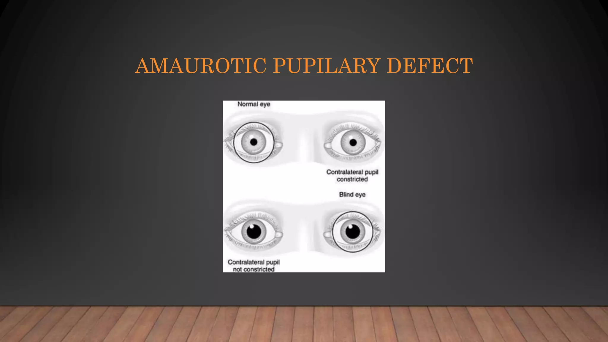 PUPILARY REFLEX PATHWAYS.pptx