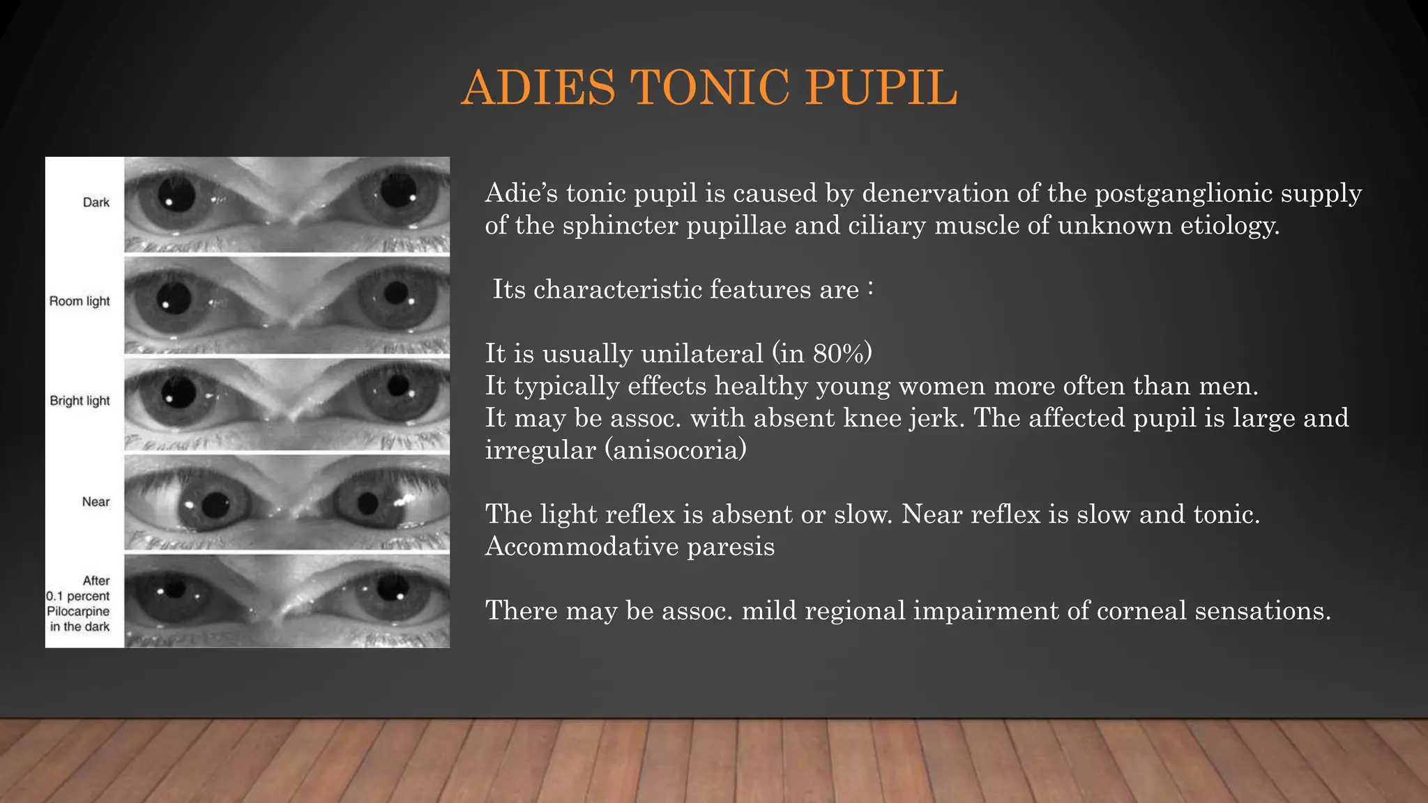 PUPILARY REFLEX PATHWAYS.pptx