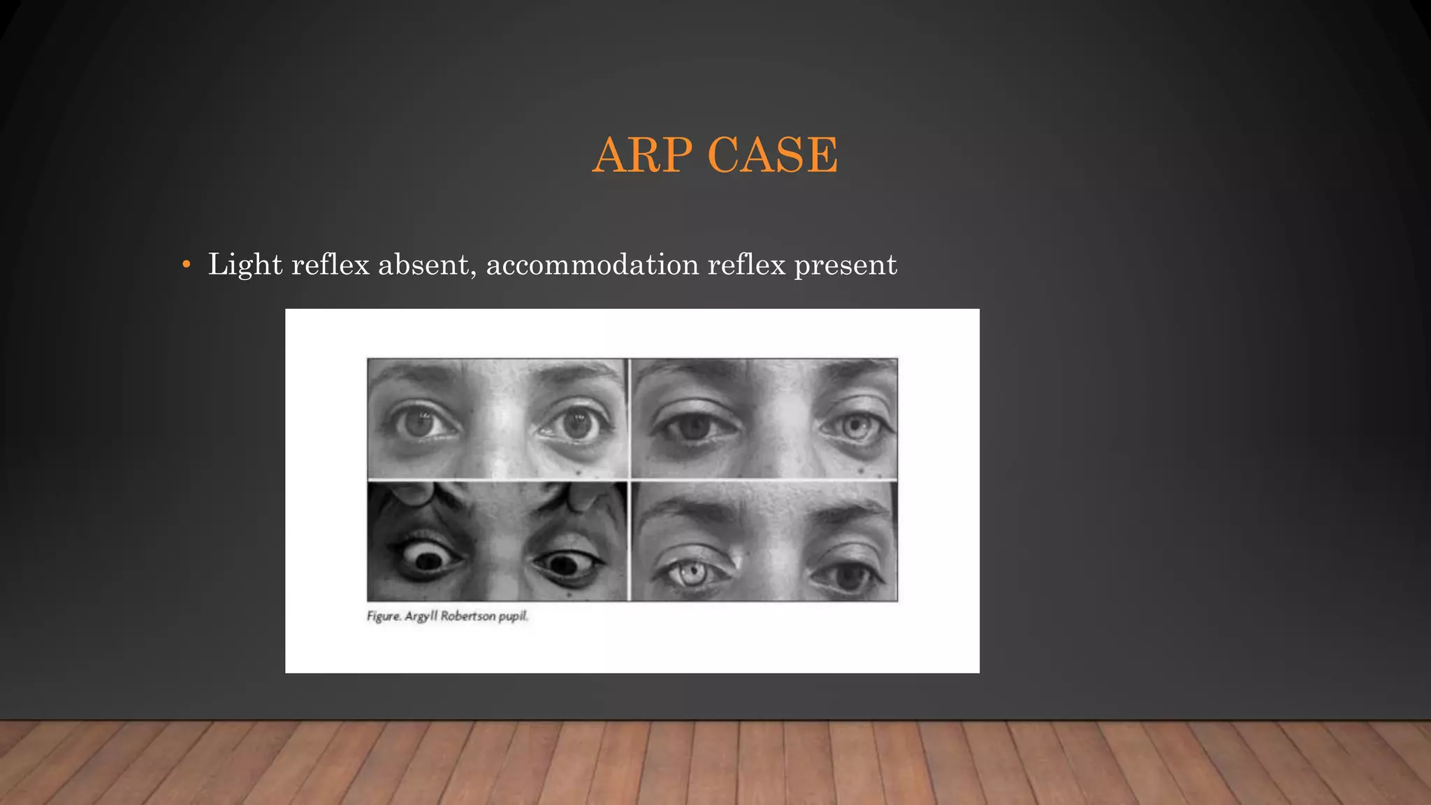 PUPILARY REFLEX PATHWAYS.pptx