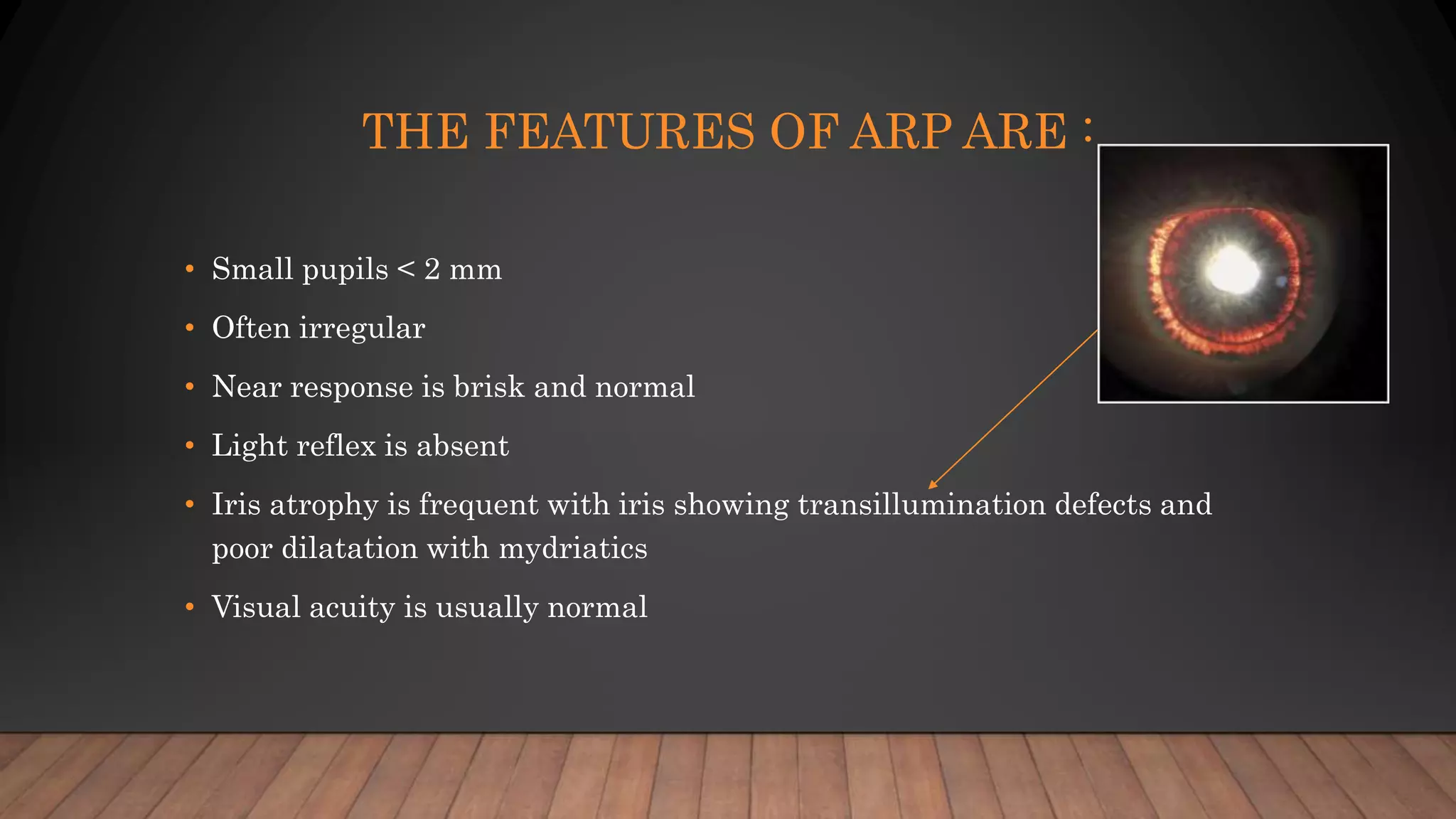 PUPILARY REFLEX PATHWAYS.pptx