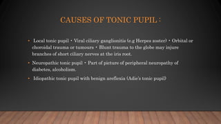 PUPILARY REFLEX PATHWAYS.pptx
