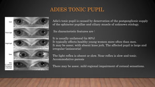 PUPILARY REFLEX PATHWAYS.pptx