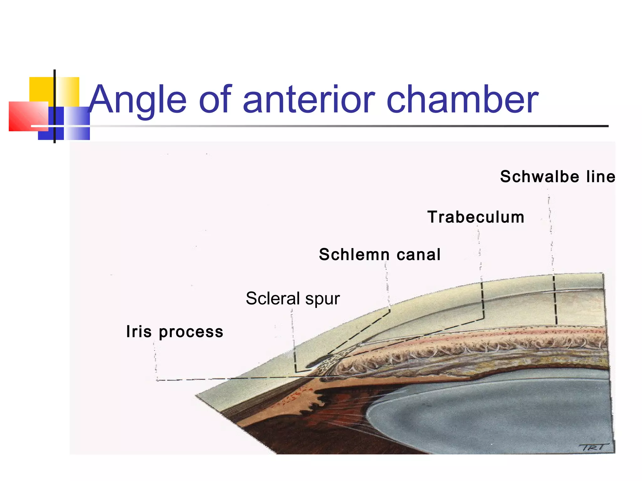Pupil block glaucoma | PPT