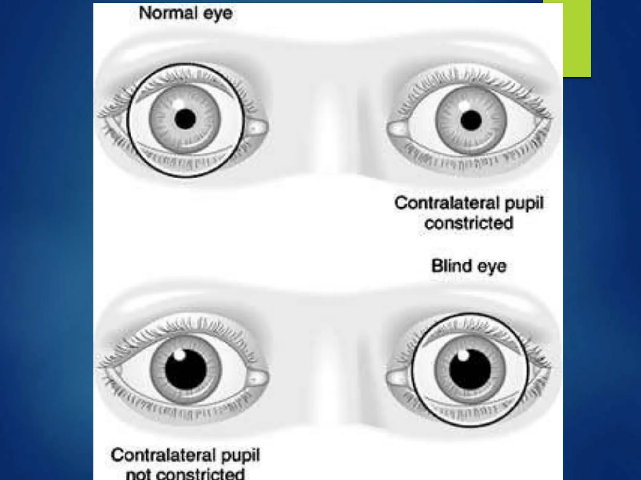 pupil examination step by step for ophthalmic exam.pptx