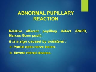 pupil examination step by step for ophthalmic exam.pptx