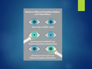 pupil examination step by step for ophthalmic exam.pptx