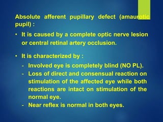 pupil examination step by step for ophthalmic exam.pptx