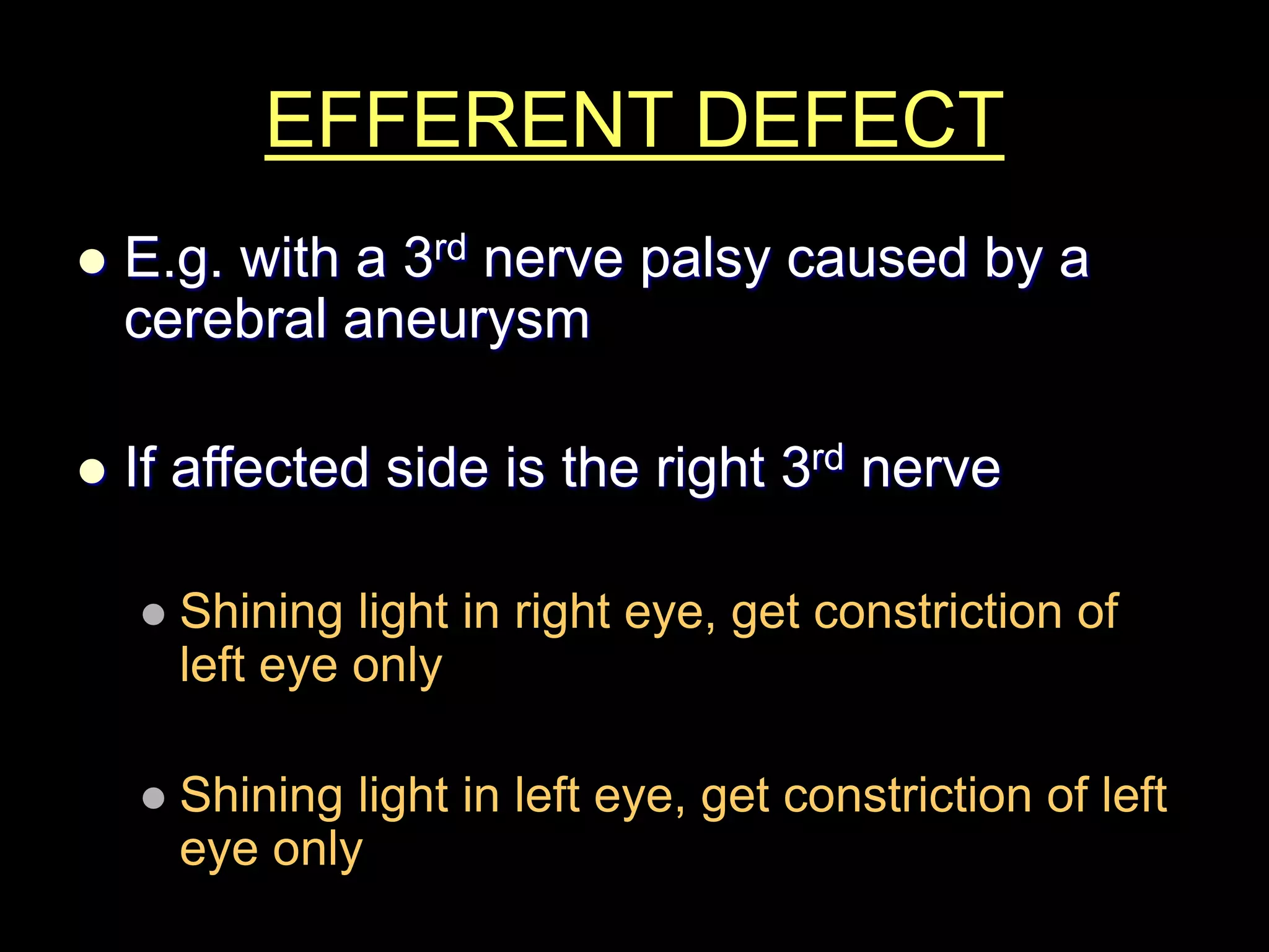 Pupil examination | PPT