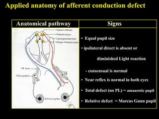 Pupil examination | PPT