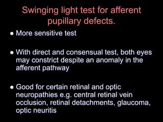 Pupil examination | PPT