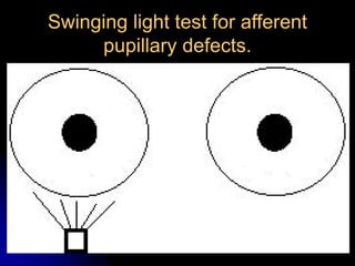 Pupil examination | PPT
