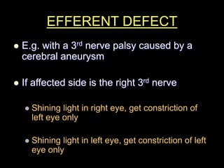 Pupil examination | PPT
