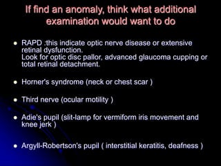 Pupil examination | PPT