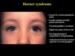 Pupil examination | PPT