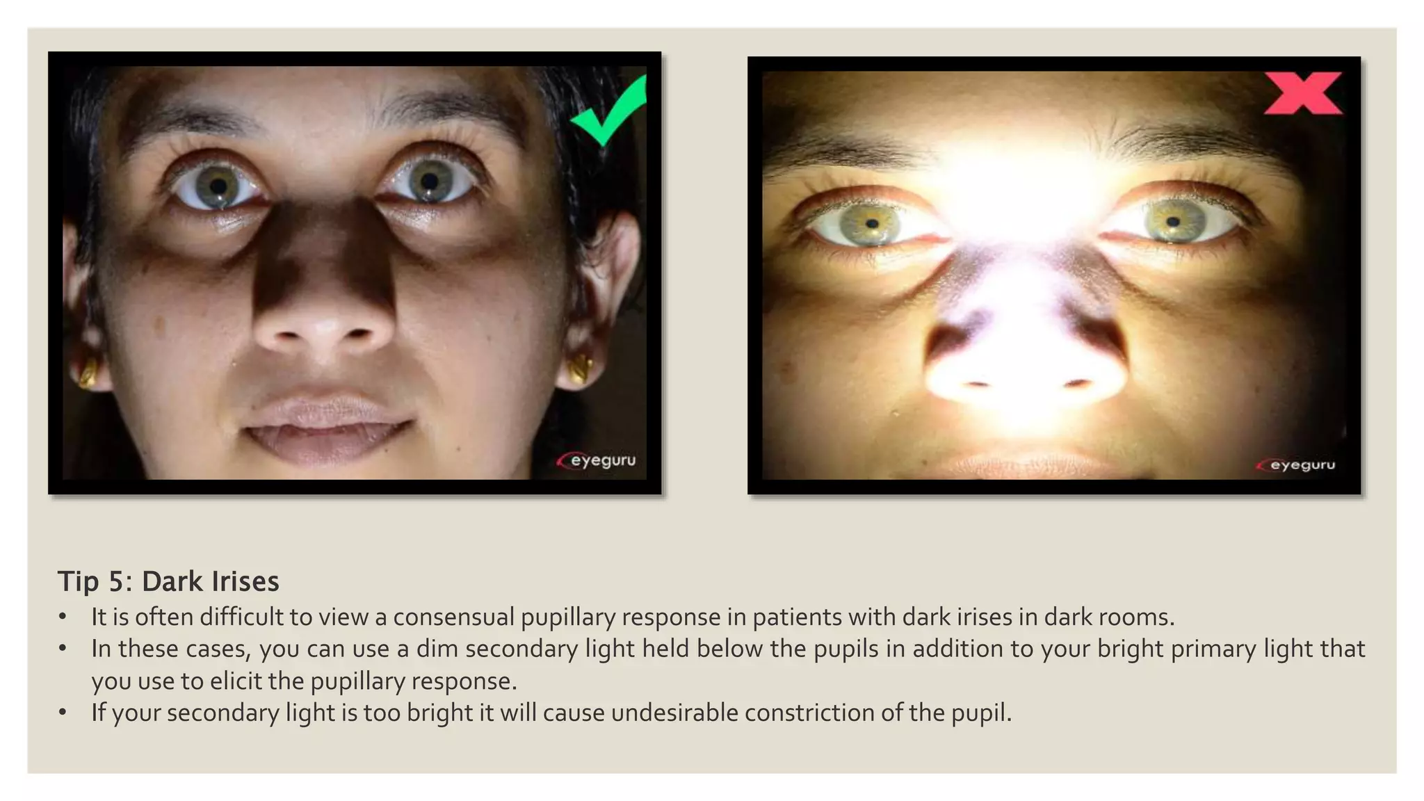 Pupil examination | PPTX
